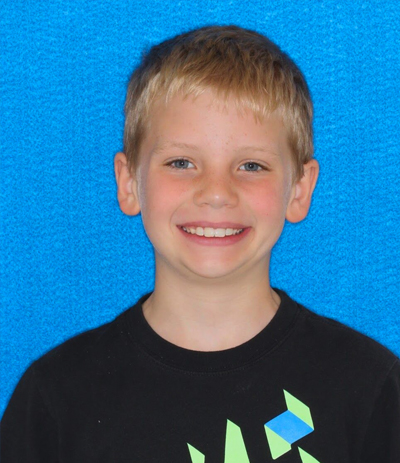 Before / After – Pickering & Allen Orthodontics