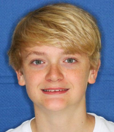 Before / After – Pickering & Allen Orthodontics